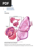 BTS Guideline For Bronchiectasis in Adults - A Summary For The General ...