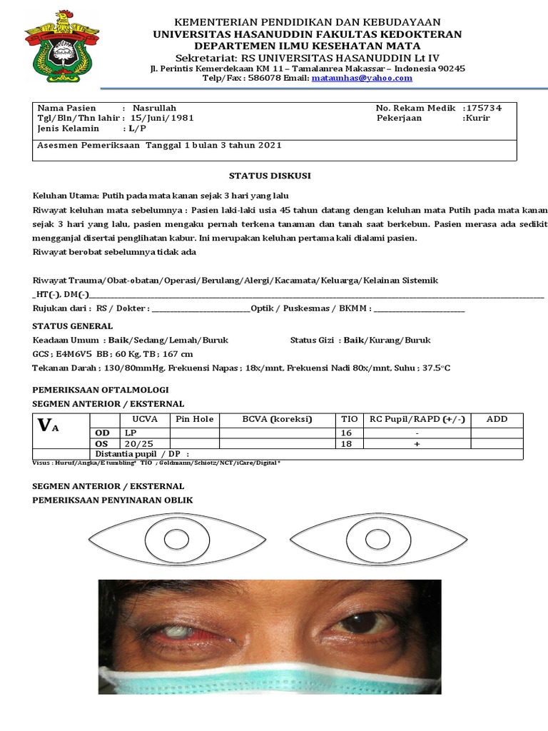 Kelompok 2 Status Mata Merah Visus Turun (Ulkus Kornea) | PDF