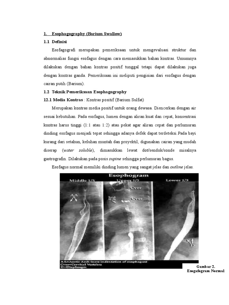 Referat Esofagografi | PDF | Kesehatan Holistik