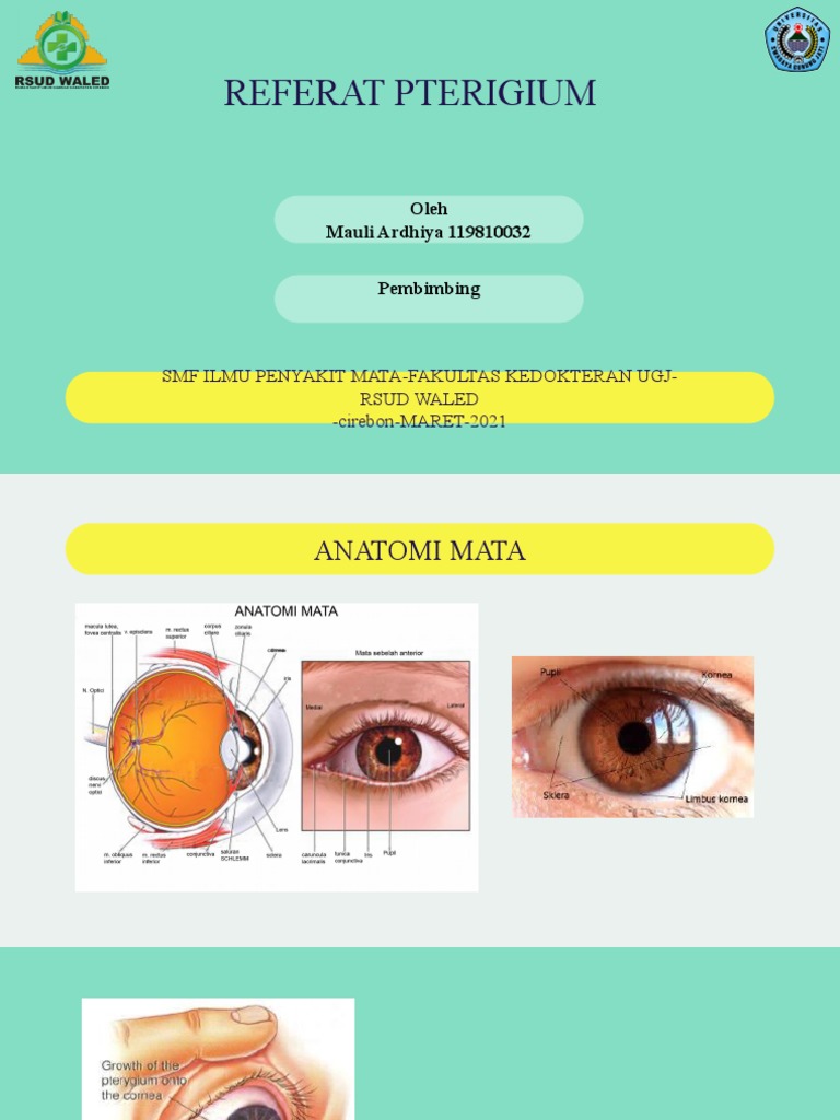 Pterygium | PDF