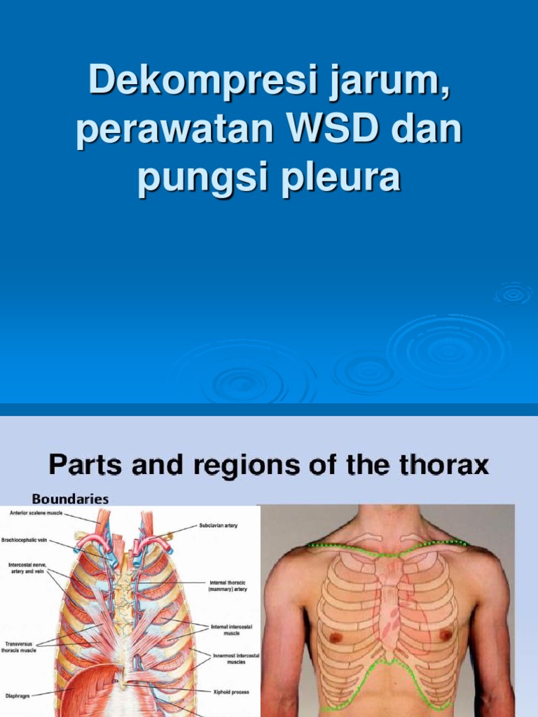 Decompressi WSD Efusi Pleura | PDF
