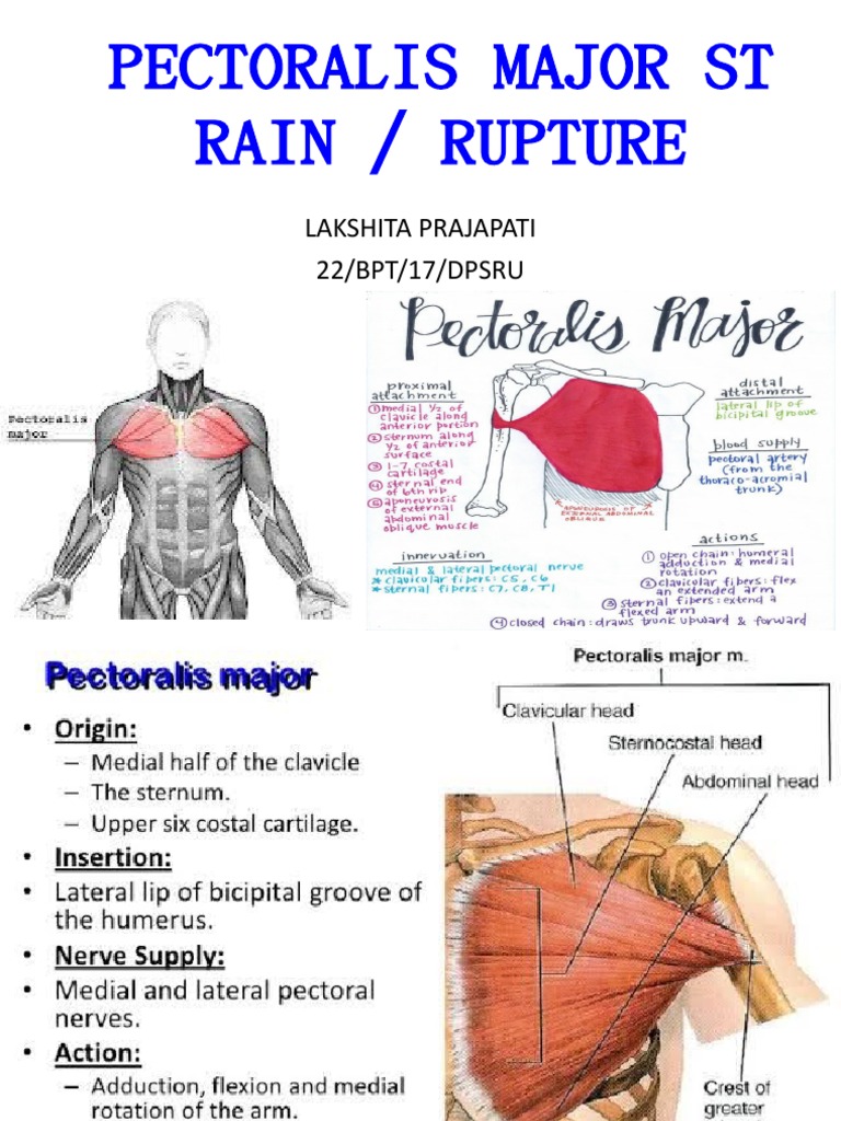 Pectoralis Major Strain and Management | PDF | Tendon | Shoulder