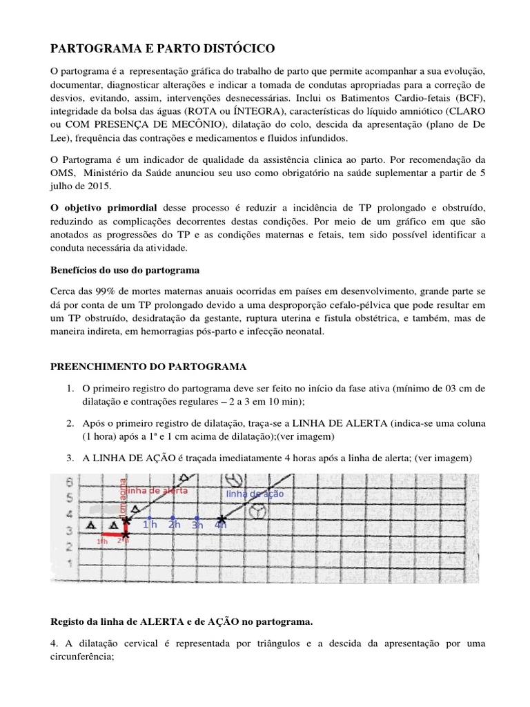 Uma explicação detalhada sobre o partograma, sua importância e ...