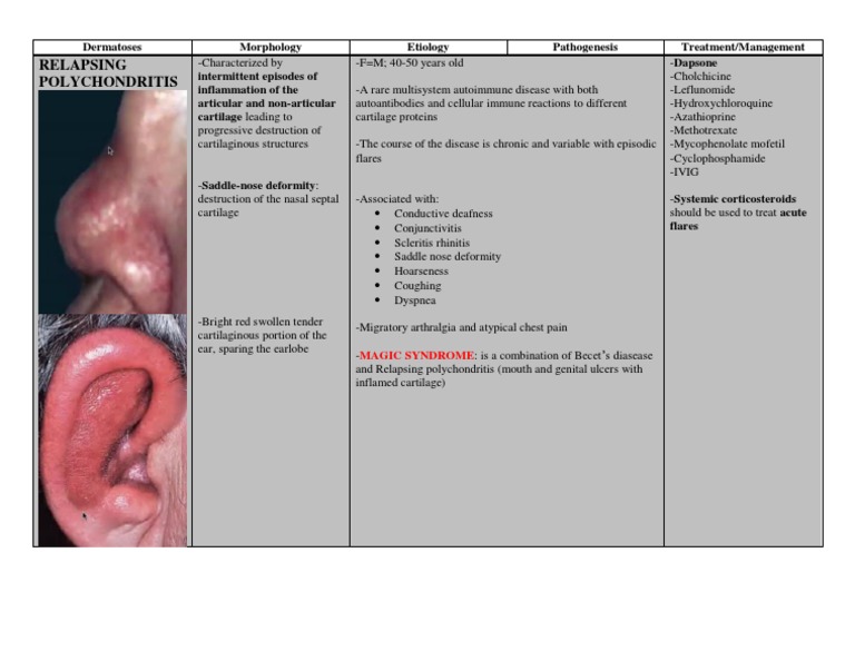 Relapsing Polychondritis | PDF | Clinical Medicine | Medical Specialties