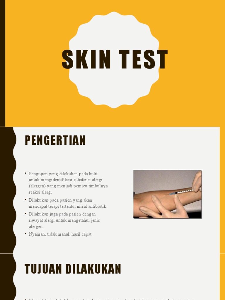 Skin Test | PDF