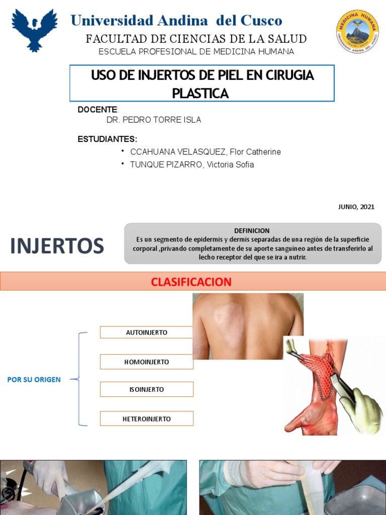 CIRUGIA PLASTICA GRUPO 11 Cirugía Reconstructiva - Injertos de Piel ...