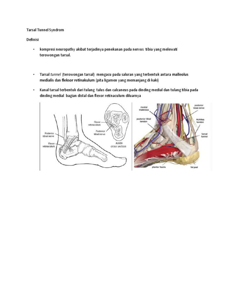 Tarsal Tunnel Syndrom | PDF