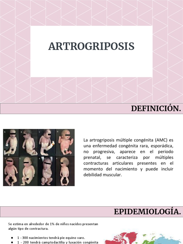 Artrogriposis | PDF | Enfermedades y trastornos humanos ...