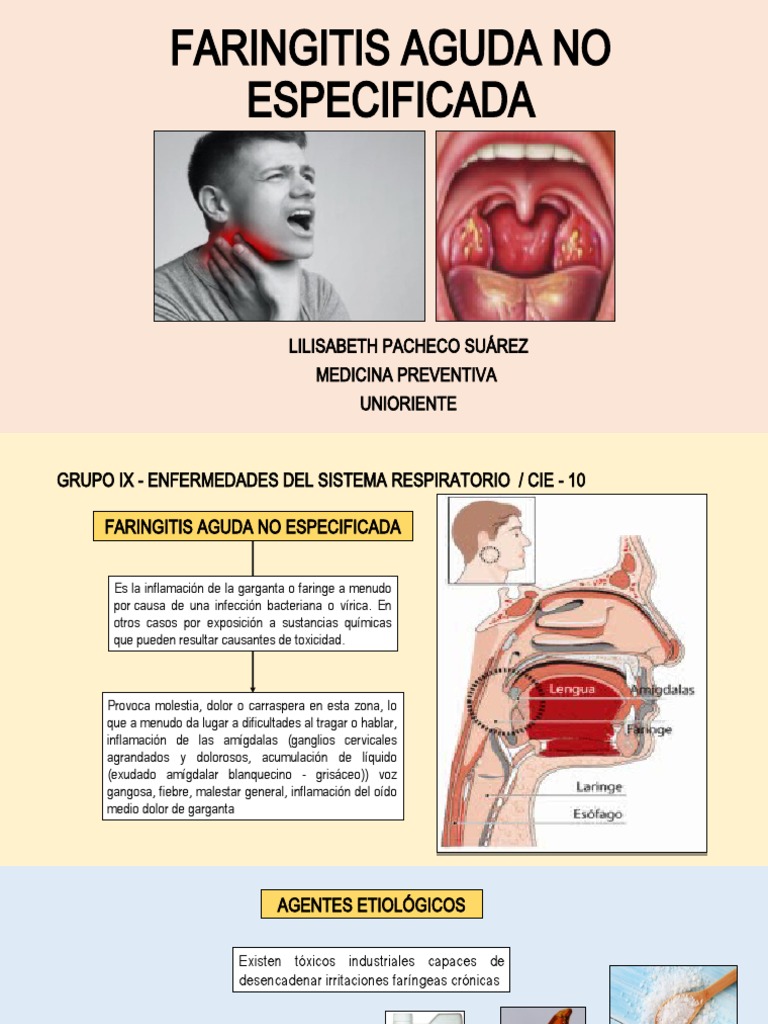 Faringitis Aguda No Especificada | PDF