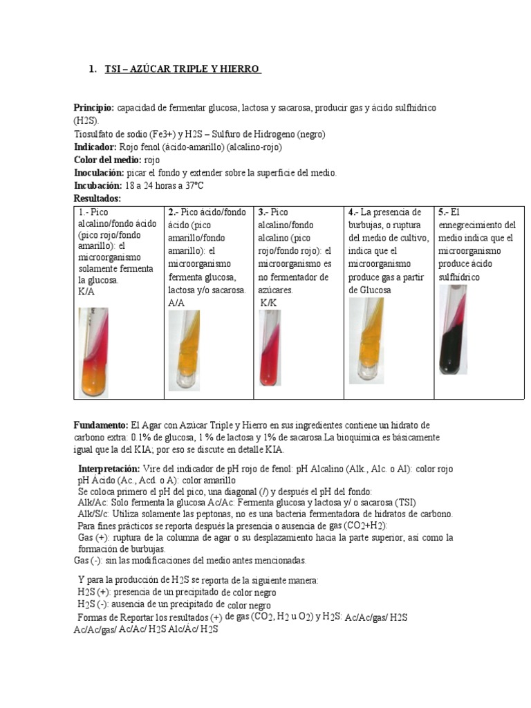 Prueba Tsi Microbiología