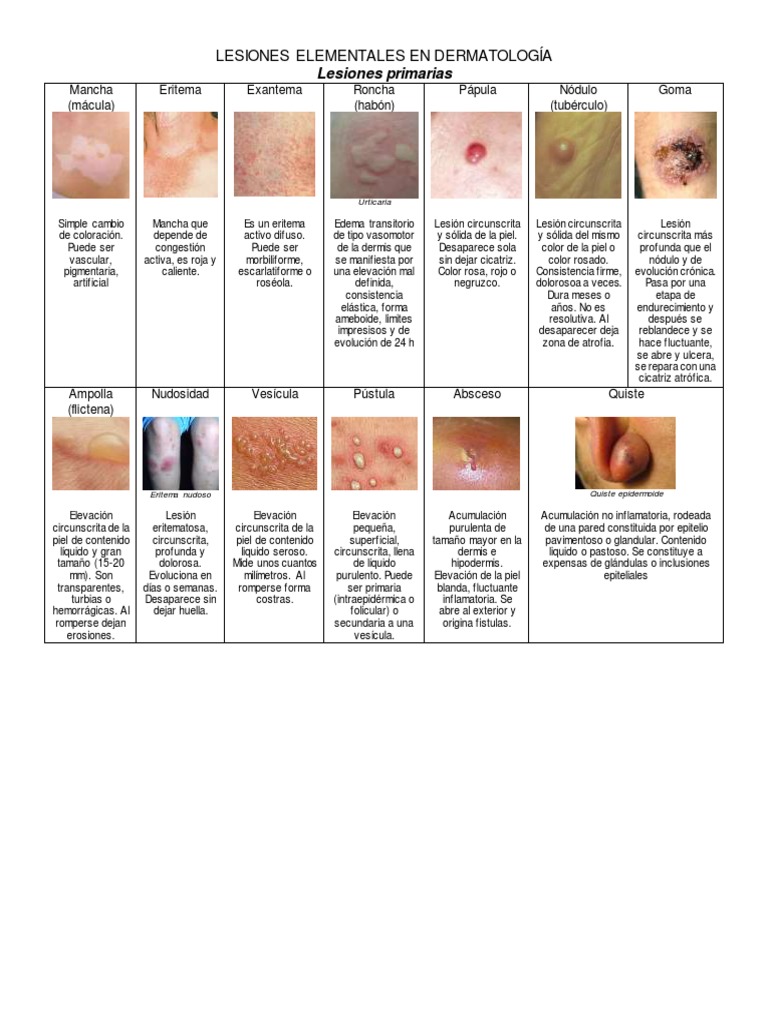 Lesiones Elementales en Dermatologia | PDF | Piel | Epidermis