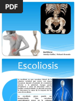 Prueba de Adams | PDF | La columna vertebral | Escoliosis