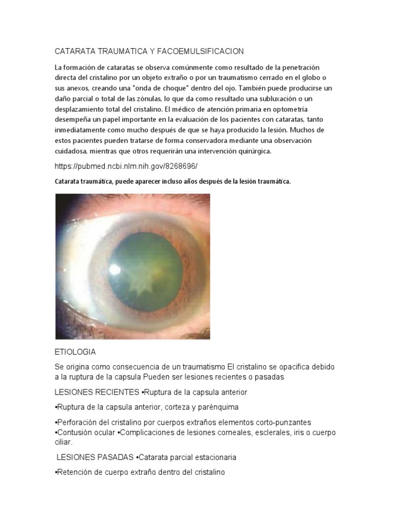 Catarata Traumatica y Facoemulsificacion | PDF | Catarata | Oftalmología