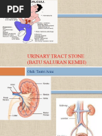 ICD10 N20.1 Batu-Ureter v011220 | PDF