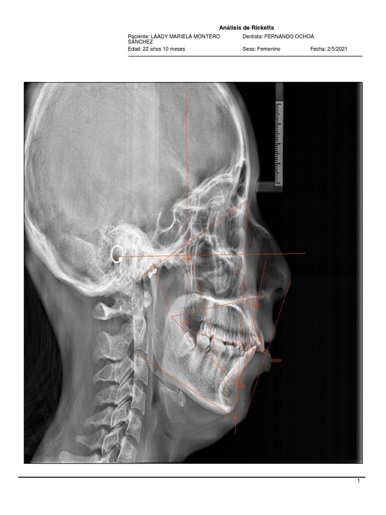 Ricketts | PDF | Rasgos faciales | Cabeza y cuello humanos