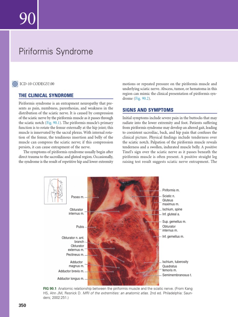 Piriformis Syndrome: The Clinical Syndrome Signs and Symptoms | PDF ...