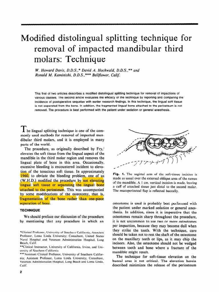 Modified distolingual splitting technique for removal of impacted ...