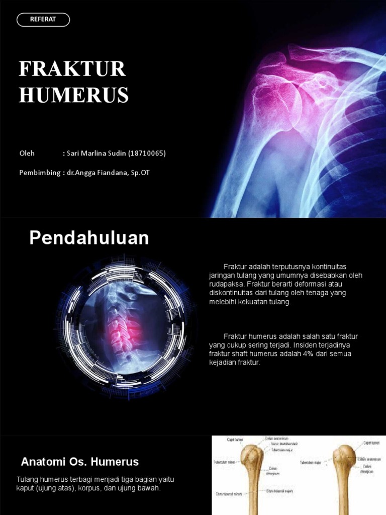 Fraktur Humerus | PDF