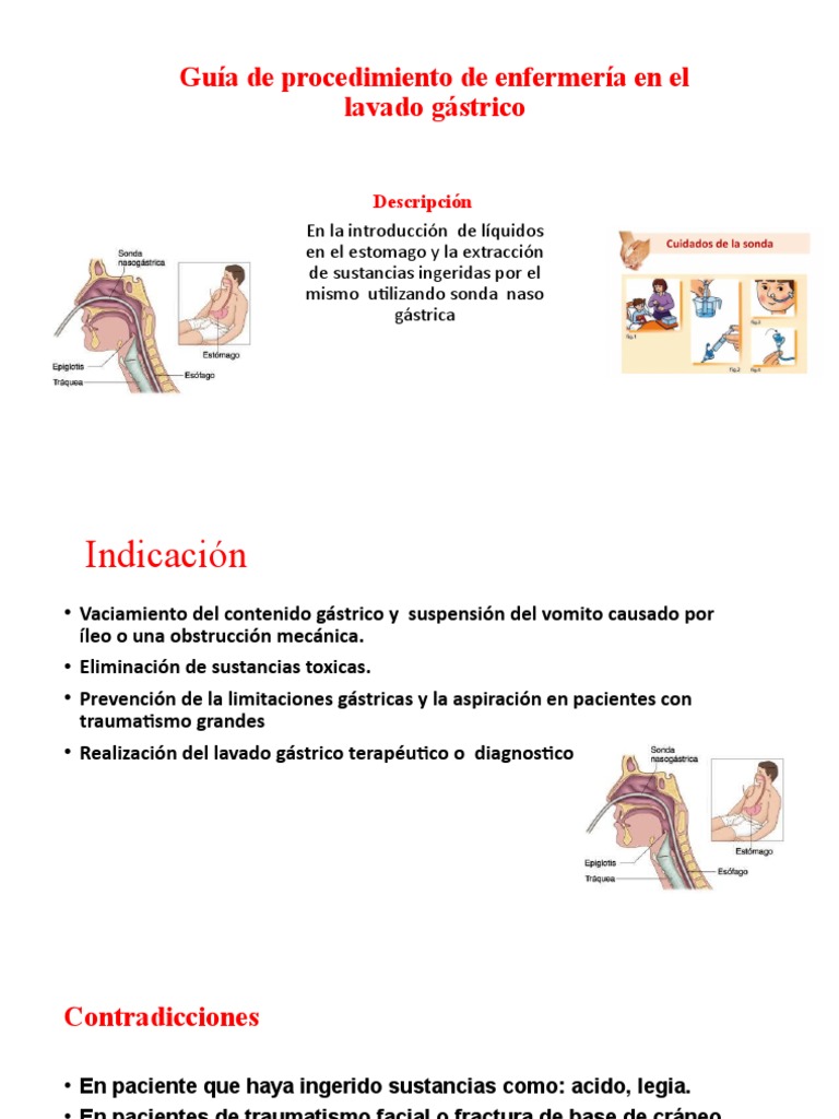 Guía de Lavado Gástrico en Enfermería | PDF