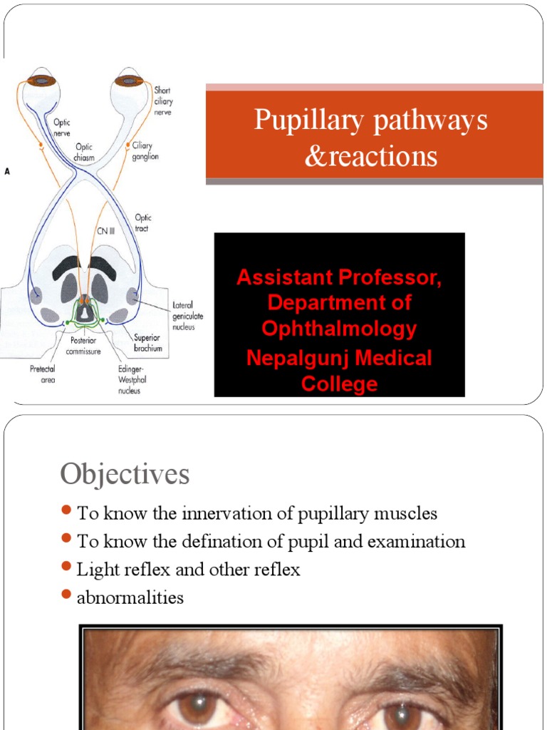 Pupillary Pathways &reactions: Assistant Professor, Department of ...