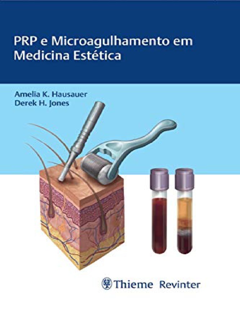 Resumo PRP Microagulhamento Medicina Estetica 09e9 | PDF