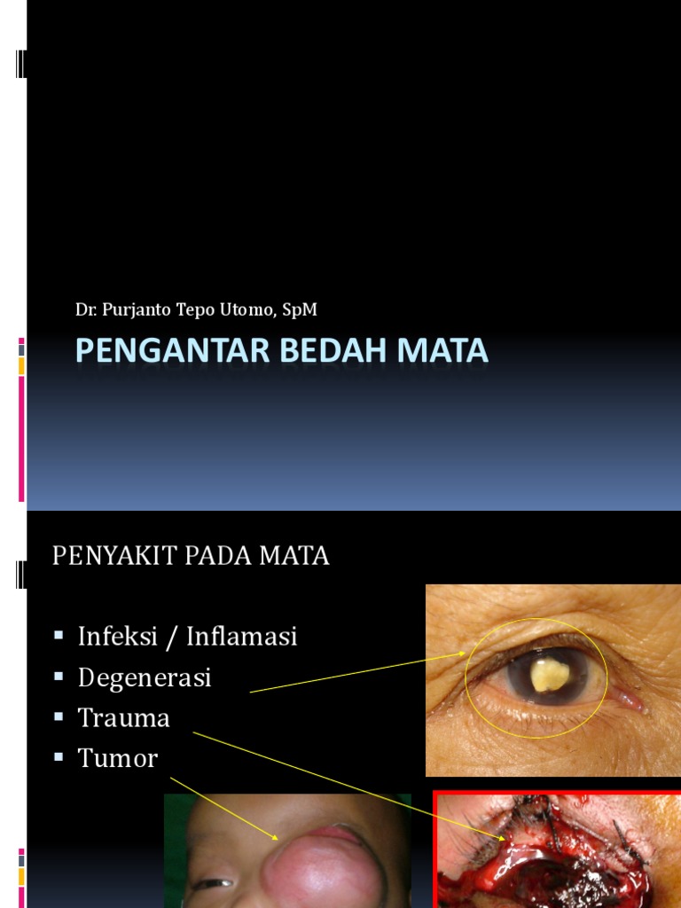 Persiapan Bedah Mata | PDF