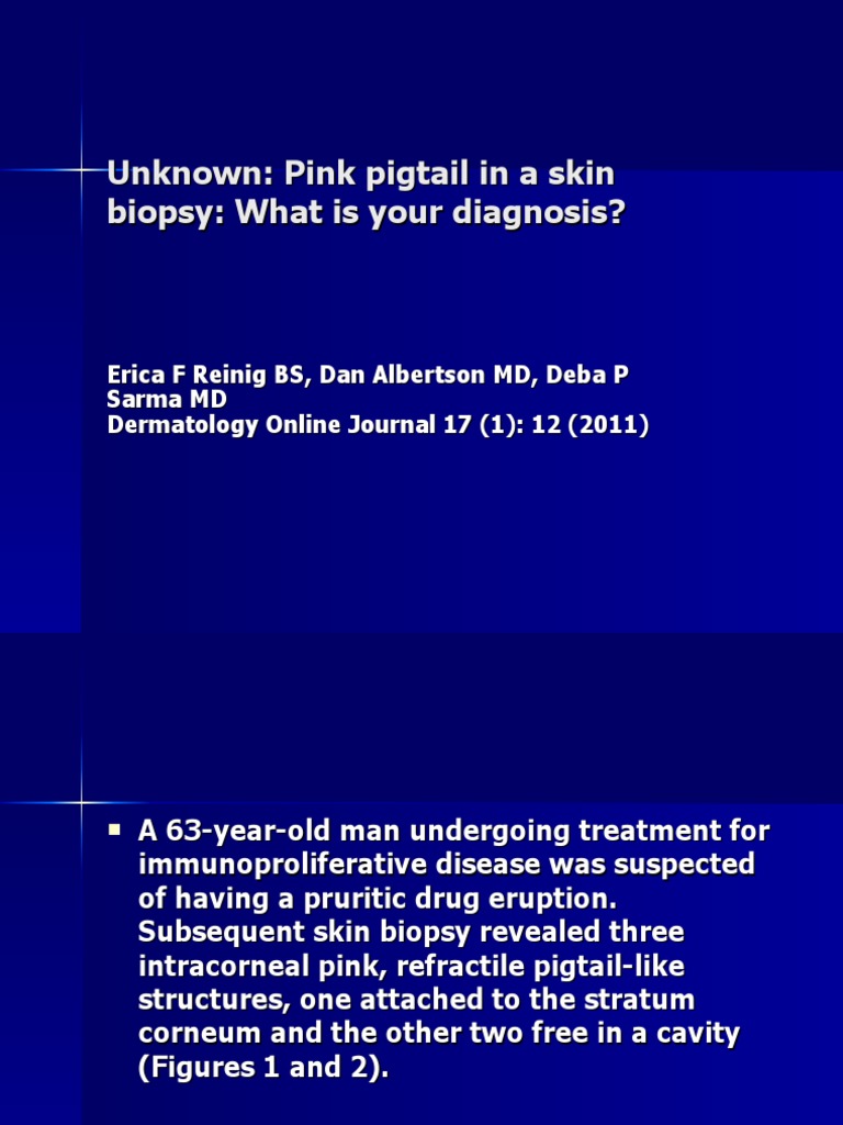 Pink Pigtail in A Skin Biopsy: Scabies | PDF | Microbiology | Medicine