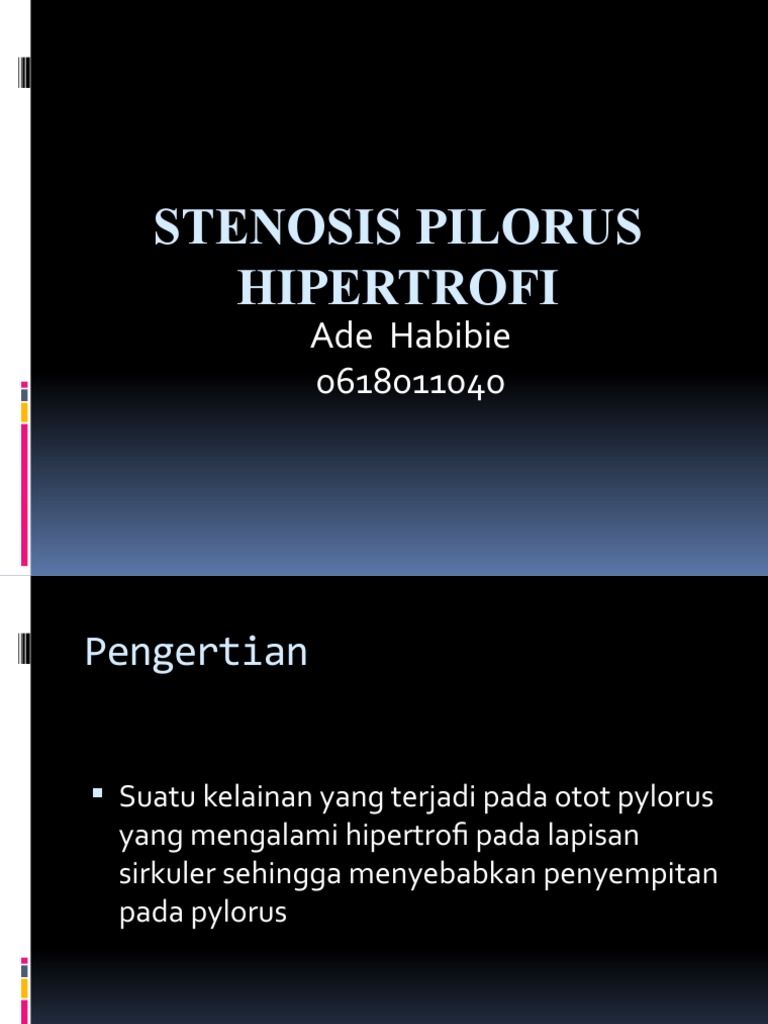 PTT Stenosis Pilorus | PDF