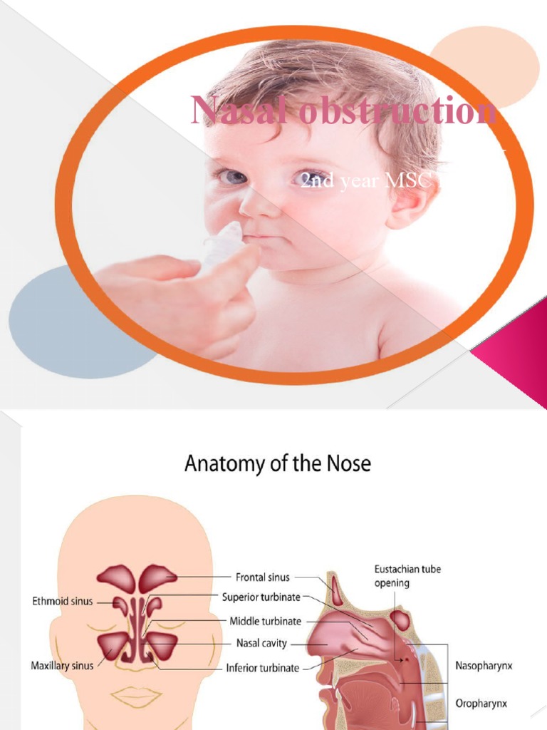 Nasal Obstruction: Nitha K 2nd Year MSC Nursing | PDF | Human Nose | Ear