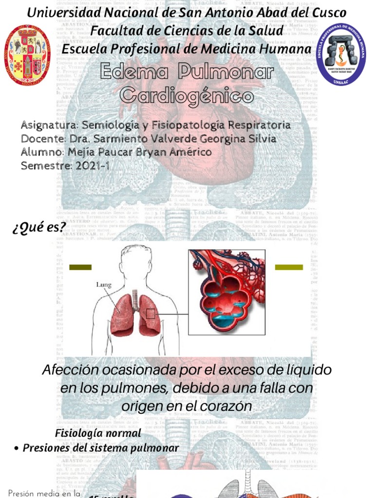 Edema Pulmonar Cardiogénico: Causas y Tratamiento | PDF | Insuficiencia ...