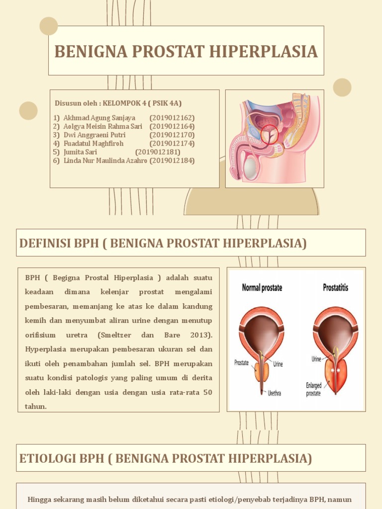 Definisi dan Penanganan BPH | PDF | Kesehatan Holistik