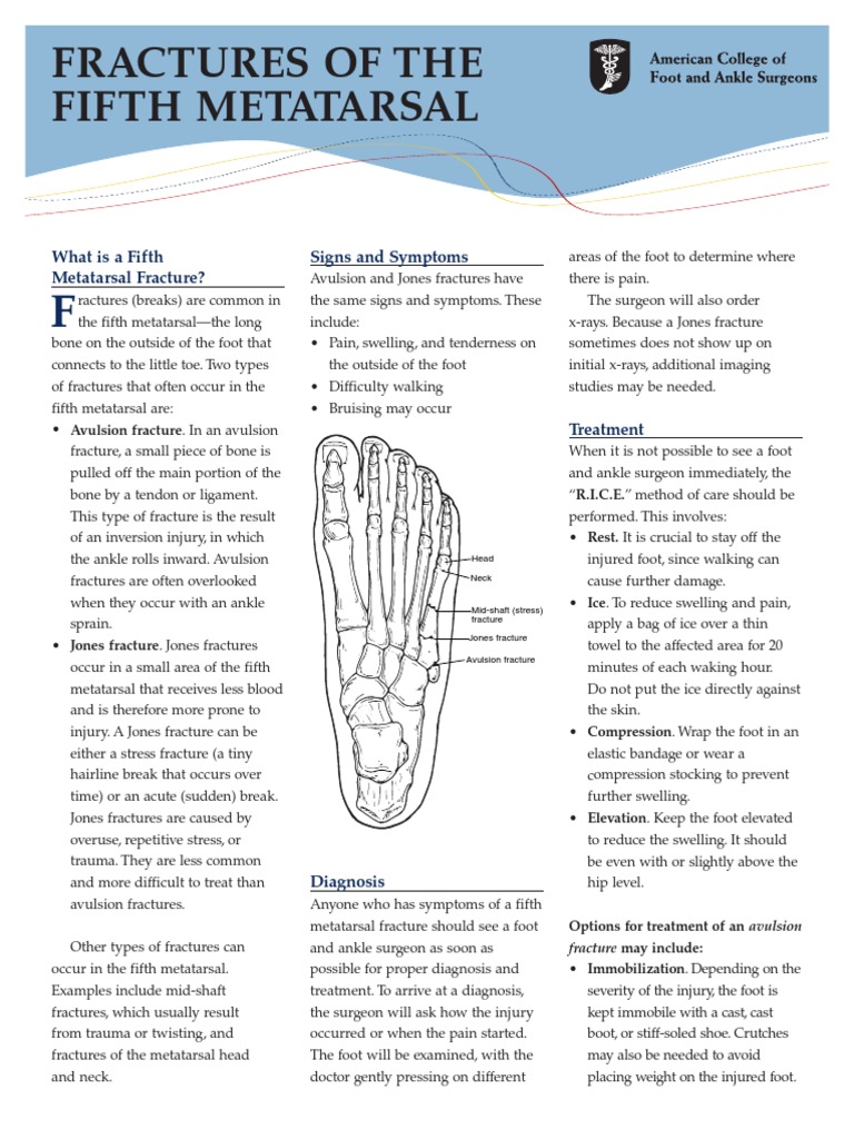 Fractures of The Fifth Metatarsal: What Is A Fifth Metatarsal Fracture ...