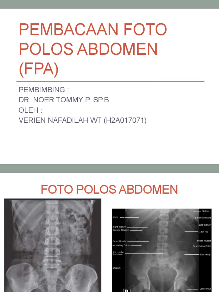 Pembacaan Foto Polos Abdomen (FPA) | PDF