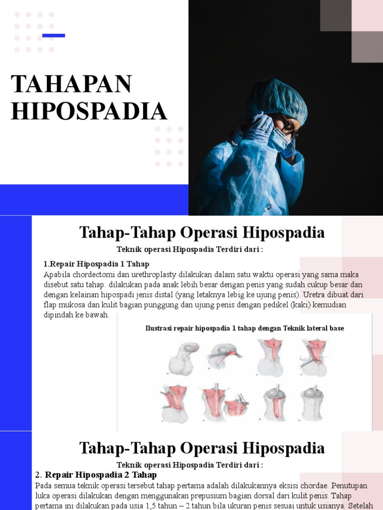 Hipospadia | PDF