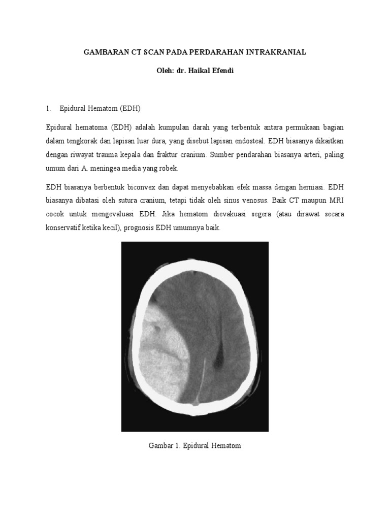 CT Scan Trauma | PDF
