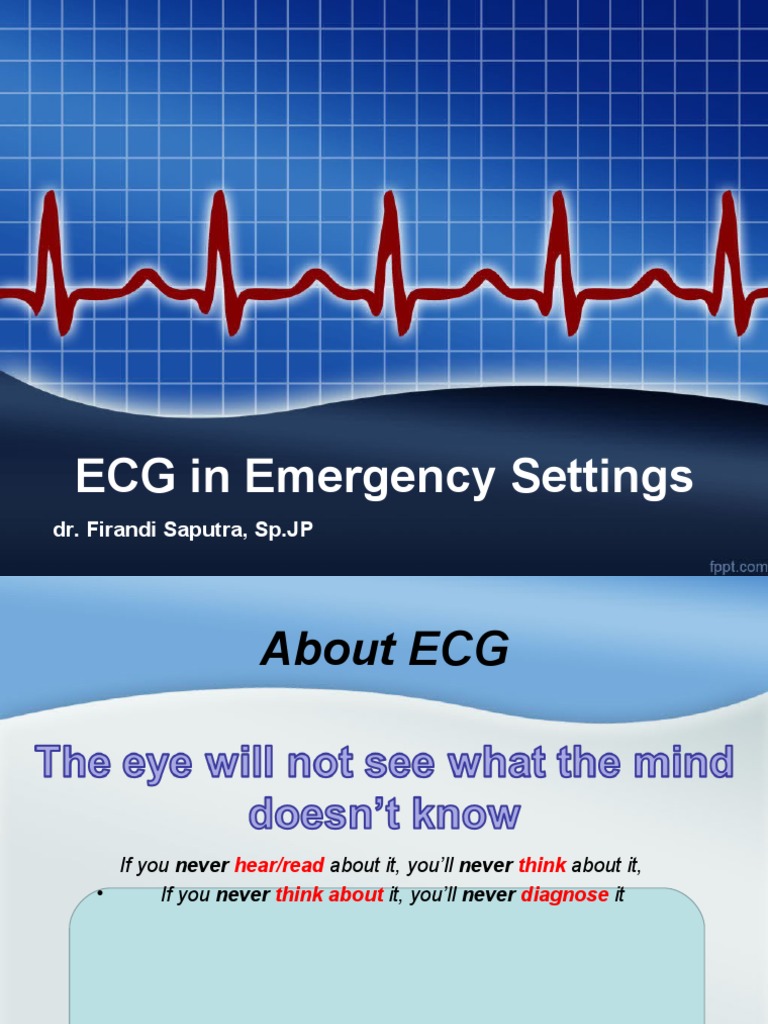 ECG in Emergency Settings: Dr. Firandi Saputra, SP - JP | Download Free ...