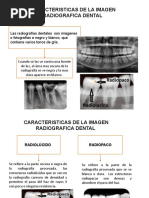 Oclusion Fosa Cuspide | PDF | Anatomia dental | Diente
