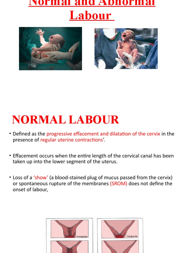 Normal Abnormal Labour | Download Free PDF | Childbirth | Female Mammals