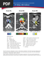 EBUS Mediastinal LN Mapping Guide | PDF | Lung | Respiration