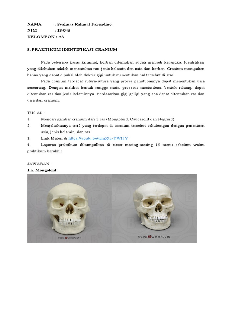 Syahnas Rahmat Farendino 18-046 Identifikasi Cranium | PDF