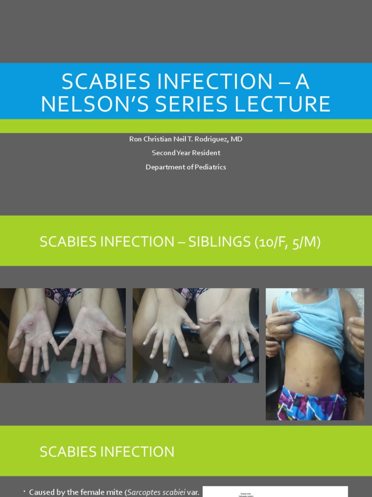 Scabies Infection - A Nelson's Series Lecture | PDF | Dermatitis | Rtt