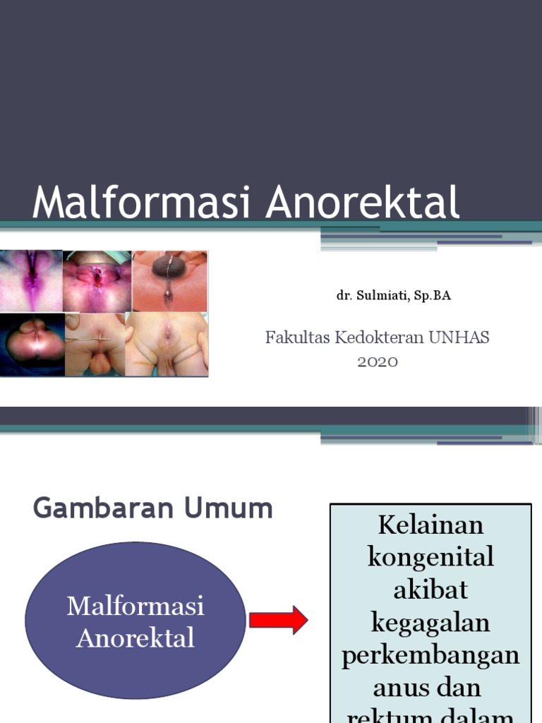 23 Malformasi Anorektal | PDF