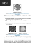 Metode Total Plate Count untuk Hitung Bakteri | PDF