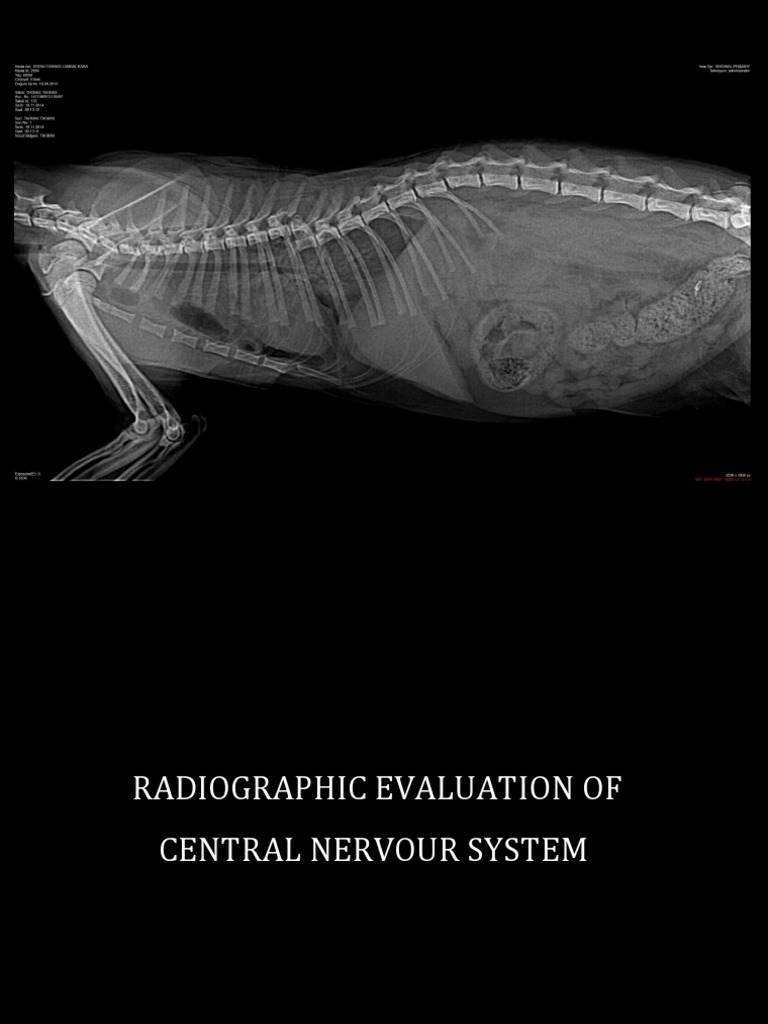 Cns | PDF | Radiography | Radiology