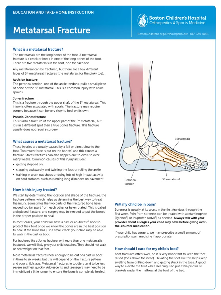 Metatarsal Fracture Guide | PDF | Foot | Ankle