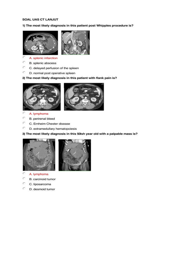 UAS CT Diagnosis Questions and Answers | PDF | Neoplasms | Causes Of Death