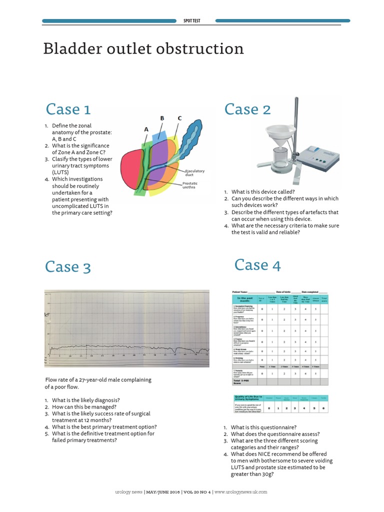 Case 1 Case 2: Bladder Outlet Obstruction | Descargar gratis PDF ...