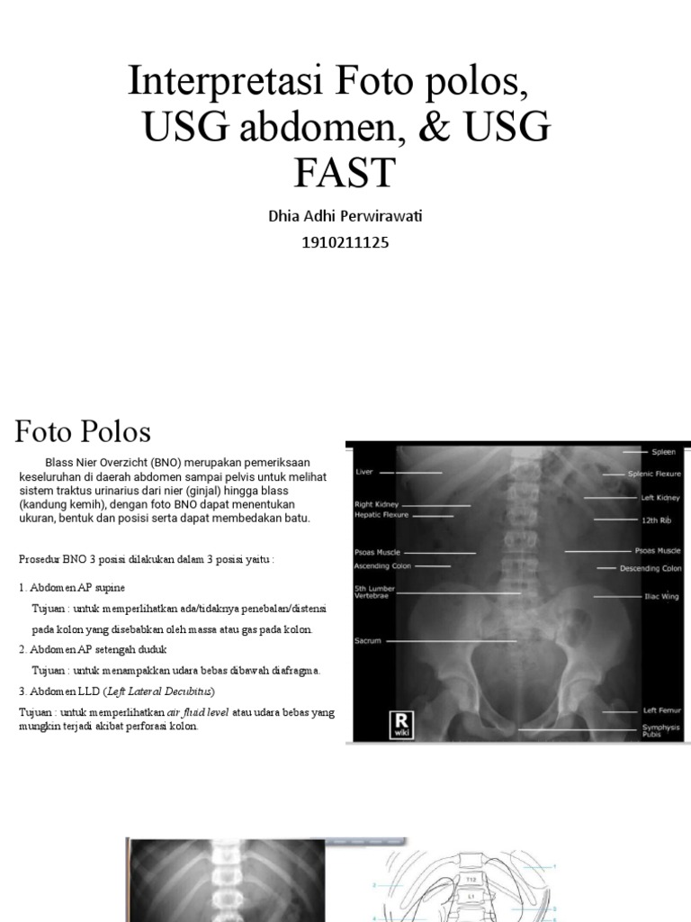 Interpretasi Foto Polos, USG Abdomen, & | PDF | Kesehatan Holistik