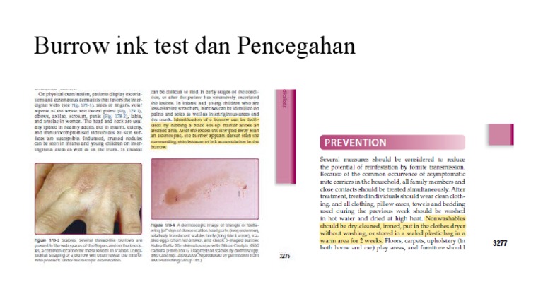 Burrow Ink Test Dan Pencegahan | PDF