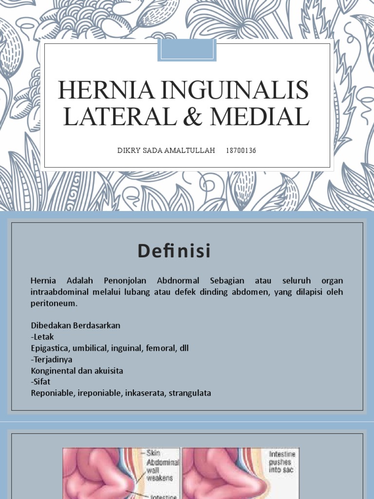 HERNIA INGUINALIS LATERAL & MEDIAL: PENJELASAN TERPERINCI MENGENAI PENYAKIT HERNIA INGUINALIS ...